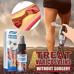 OUKPANE 2pcs Veinhealing Varicose Veins Treatment Spray, Veinhealing Varicose Veins Spray, Vein Healing Varicose Veins Treatment Spray for Legs, Varicose Veins Miracle Spray (30ml)