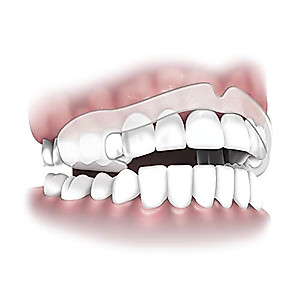 Plackers Grind No More Dental Night Guard for Teeth Grinding, 14 Count