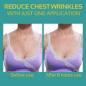 AGOPLEE Chest Wrinkle Pads, Pack of 5 100% Medical Grade Anti-Aging Advanced Skin Firming Tightening & Moisturizing Patches, Décolleté Anti Wrinkle Patches, Overnight Wrinkle Remover Treatment