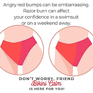 Bikini Calm Razor Burn Relief (Full Size, 8 oz.)