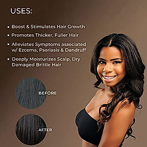 Sunny Isle Jamaican Black Castor Oil 8oz | 100% Natural Treatment for Hair, Scalp and Skin