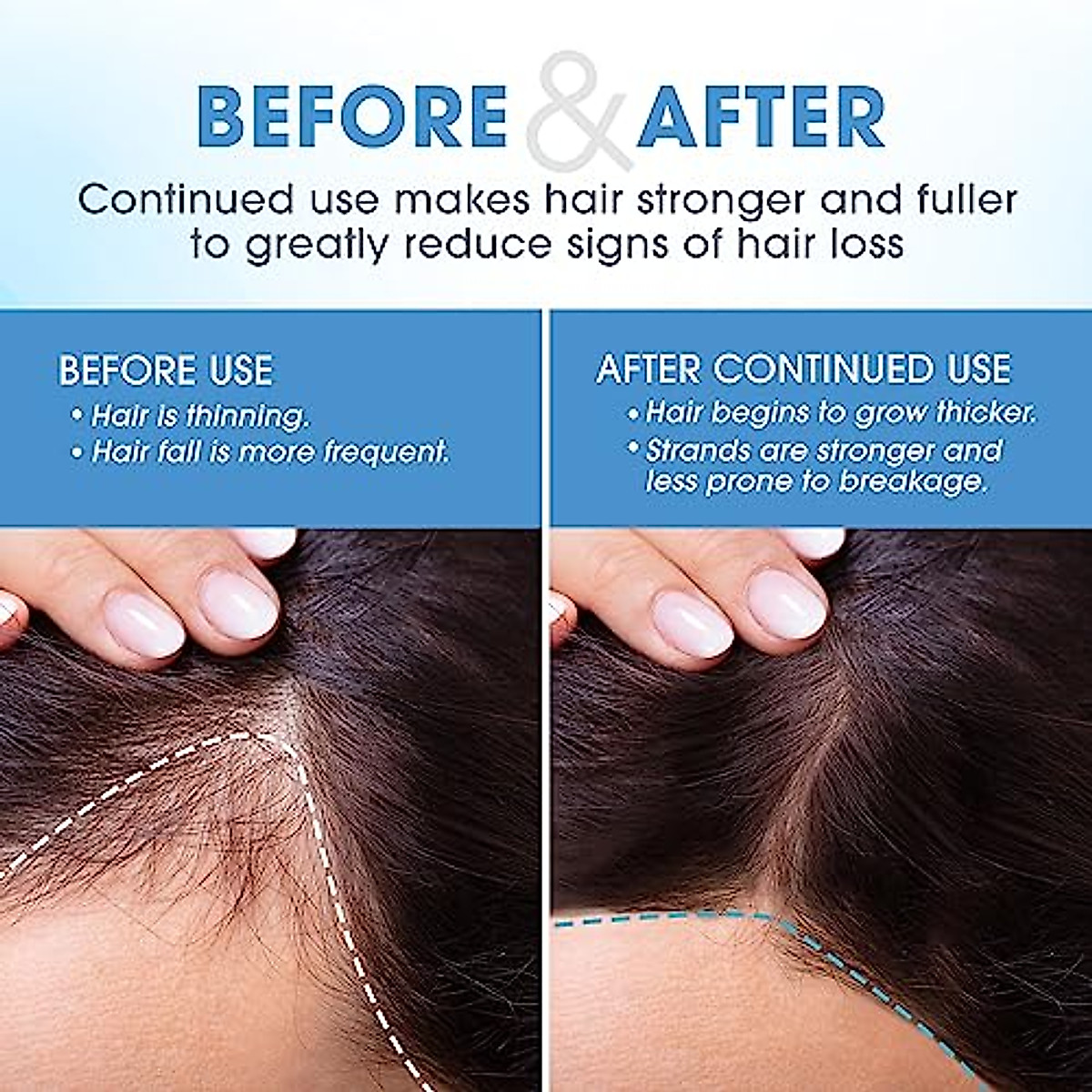 Biotin Hair Growth Shampoo And Conditioner For Women And Men With DHT Blockers, Shampoo and Conditioner For Thinning Hair and Hair Loss, Paraben Free, Sulfate Free, 16 oz. (473 ml) Bottles