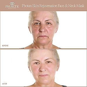 Project E Beauty LED Light Therapy Mask | LED Face & Neck Mask | Skin Rejuvenation | 7 Colors | Anti Aging | Reduce Wrinkles | Anti-inflammation | Brightening Skincare Mask