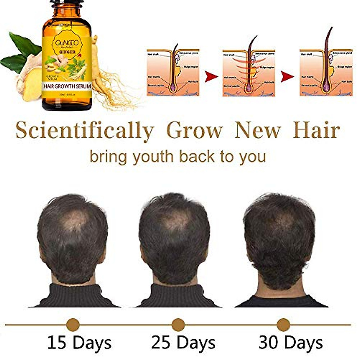 5 PACK Hair Growth Serum Liquid Hair Loss Treatment for Women & Men Dense Thicken Hair