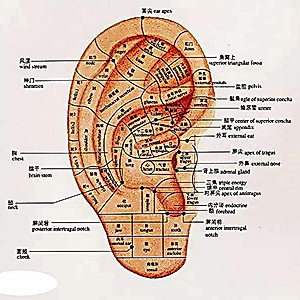 Extraction Tweezers for Hair Acupuncture Ear Seed Auriculotherapy Patch Auricular 300pcs Other Spa Night