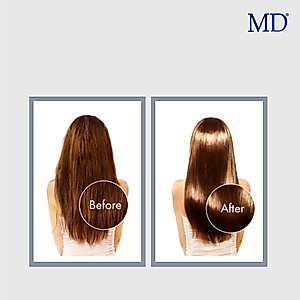 MD Revitalizing Shampoo for Men & Women – Sulphate-Free Hair Thinning Shampoo with Aloe Vera, Chamomile – Hair Loss, Regrowth Anti Thinning Shampoo for All Hair Types