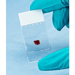 Globe Scientific 1404-15 Cover Glass, 22 x 22mm, #1.5 Thickness (Case of 10)