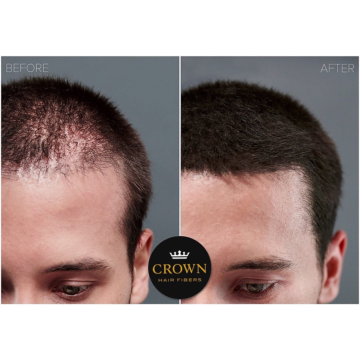 CROWN Hair Building Fibers (28g) - Instantly Cover Fine & Thinning Hair for a Thicker, Fuller Look - A Natural Keratin Concealer - 13 Shades for Men & Women - Black