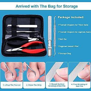 Orelex Toenail Clippers for Seniors Thick Toenails, Toe Nail Clippers Adult Long Handle for Men, Sharp Professional Heavy Duty Ingrown Toenail Tool