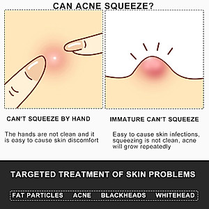 Professional Facial Milia Removal and Whitehead Extractor & Lancet - Double Ended Circle Loop & Sharp Needle Pimple Popper Tool - 2-in-1 Blackhead & Blemish Remover - Zit and Pimple Acne Removal