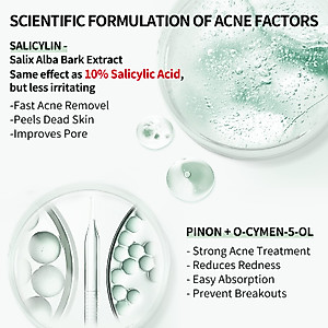 Acne Treatment Face Serum, 10% Salicylic Acid, Pimples Remover & Dead Skin Peels, Relieve Redness Rosacea Blemish, Centella Asiatica Soothing Calming, Acne Prone Sensitive Facial Skin Care, 30ml