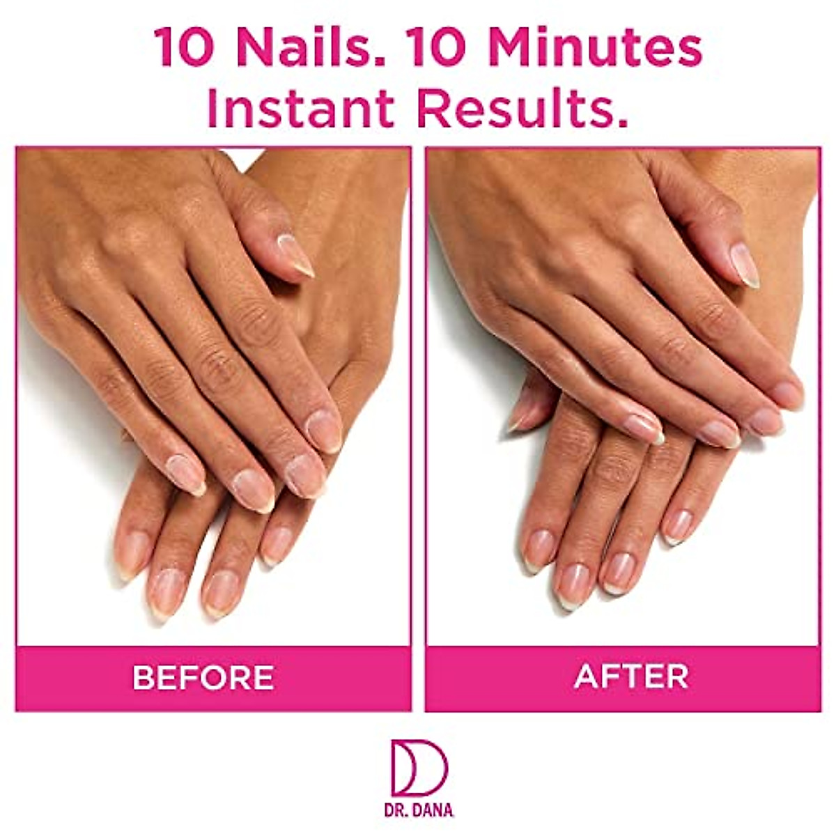 Dr. Dana Nail Repair for Damaged Nails - Nail Strengthener for Thin Nails, Nail Strengthener for Damaged Nails - Nail Products with Exfoliator, Primer Nail Buffer, and Moisturizer for Brittle Nails