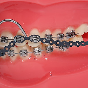 faruijie Colourful Elastic Power Chain for Braces Dental Orthodontic Powerchains 3 Sizes Ortho Rubber Band(Long,Black 9#)