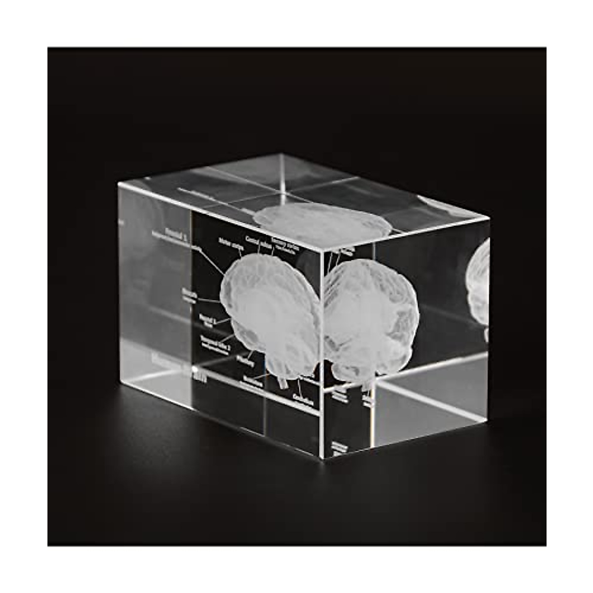 Ultrassist 3D Human Brain Crystal Model, Laser Etched Anatomical Model for Home and Office Decoration, Neurology Gifts