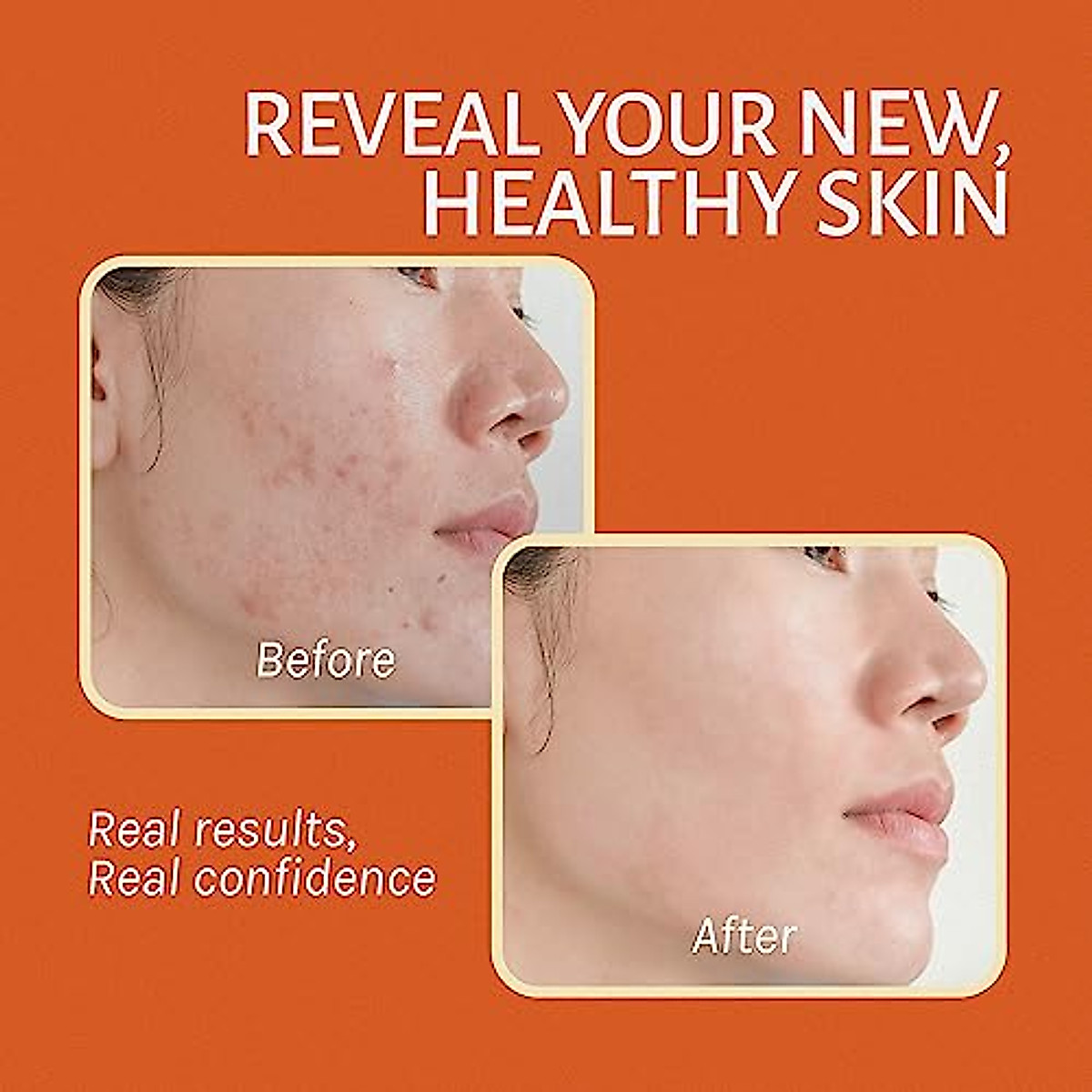 Swell Skin - Sea Buckthorn Oil for Skin Health, Facial Oil, Age-Defying Beauty Potion, Moisturizing Face Oil, Also Works on Bites & Burns, 30 ml