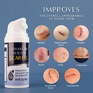 Silicone Scar Cream with Medical Grade Silicone Stretch Mark Cream Treatment - Formula Scar Gel Works for C-Section, Stretch Marks, Keloid, Acne - Surgical Scars Effective, Old and New Scars - 30g