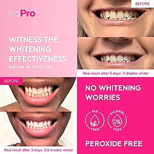 InoPro Teeth Whitening Strips 14 Treatments Kit - Teeth Whitener, Peroxide Free, Enamel Safe Green White Strips, Deep Stains Removal - Instant Teeth Whitening Without The Harm (28 Strips)