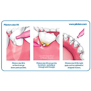 Piksters Interdental Brushes, 40 pk, Size 00, Interdental Tooth Brush for Extremely Tight Gaps, Gum Soft Bristles for Plaque Removal, Safe for Braces