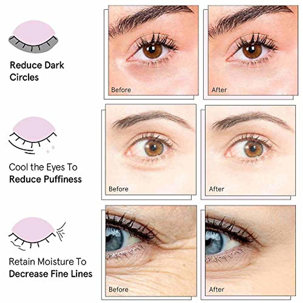 Award Winning Under Eye Mask (Pink, 48 Pairs) Reduce Dark Circles, Puffy Eyes, Undereye Bags, Wrinkles - Gel Under Eye Patches, Vegan Cruelty-Free Self Care by grace and stella