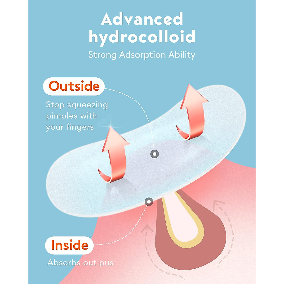 LitBear Large Acne Pimple Patches, 5 Sizes 80 Patches for Large Breakouts, Acne Patches for Face, Chin or Body, Acne Spot Patch with Tea Tree & Calendula Oil, Hydrocolloid Bandages for Acne Skin