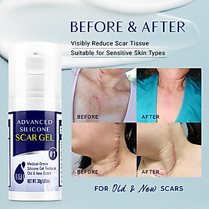 Silicone Scar Cream with Medical Grade Silicone Stretch Mark Cream Treatment - Formula Scar Gel Works for C-Section, Stretch Marks, Keloid, Acne - Surgical Scars Effective, Old and New Scars - 30g