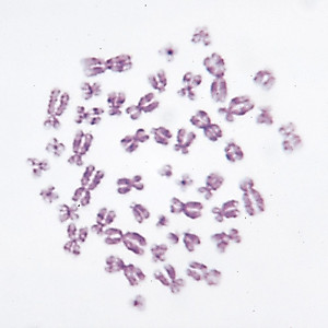 Human Male Chromosomes - 46, XY, Spread Microscope Slide