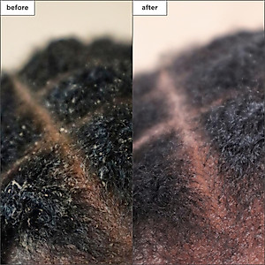 Briogeo Scalp Revival Micro-Exfoliating Shampoo and Charcoal + Tea Tree Scalp Treatment, Vegan, Phalate & Paraben-Free