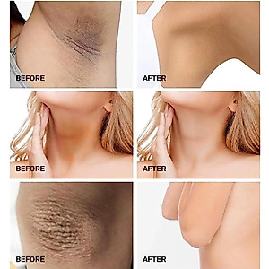 Snow Bleach Cream, Snow Bleaching, Snow Bleach Cream For Private Part Underarm Whiten (1 PCS)