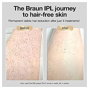 Braun IPL Long-lasting Hair Removal System for Women and Men, NEW Silk Expert Pro 5 PL5347, Head-to-toe Usage, for Body & Face, Alternative to Salon Laser Hair Removal, With 3 Extra Caps