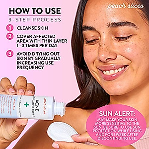 Peach Slices | Acne Exfoliating Toner | 2% Salicylic Acid | AHA+BHA Exfoliation | Facial Cleanser | Calms & Soothes | Prevents Breakouts | Alcohol & Sulfate Free | Skin Care for Women & Men | 4 Oz
