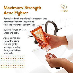 AcneFree Severe Acne 10% Benzoyl Peroxide Foaming Cleansing Wash, 5 Ounce