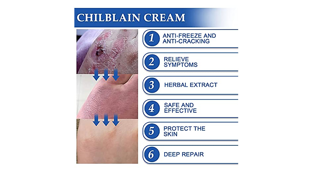 LONGLUAN Chilblain Cream - Deep Moisturizer for Cracked Skin