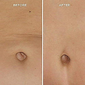 COSMEDIX A-Lift Overnight Vitamin A Body Treatment, 4 oz