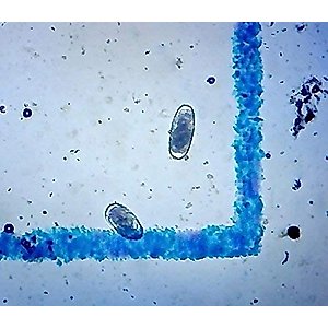 4 McMaster Method Microscope Slides, by FEC Source, Fecal/Worm Egg Count for Parasites for Veterinary Use. Livestock Parasite Management. FECRT Reference Guide Included.