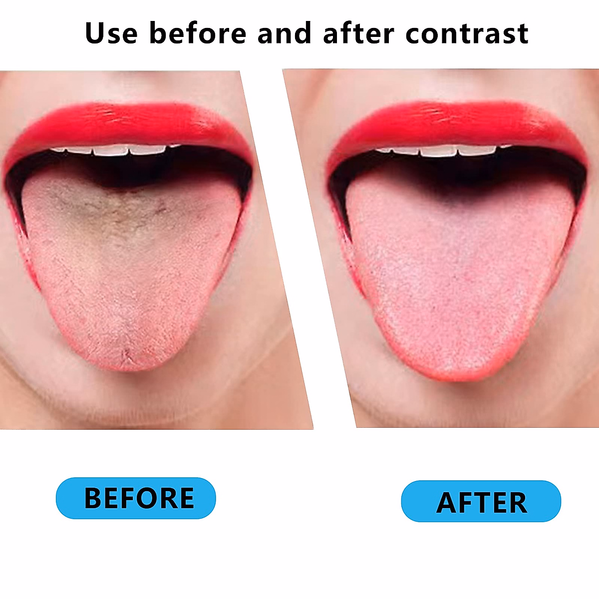 Tongue Scraper Stainless Steel Tongue Cleaners Reduce Bad Breath Metal Tough Scrapers Reduce Bad Breath and Fresh Breath for Kids And Adults