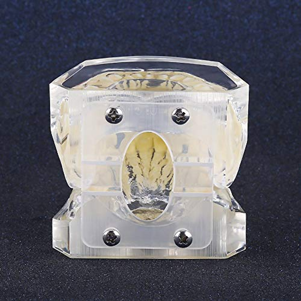 Teeth Educational Model Dental Treatment Malocclusion Study Demonstration Teeth Model with Wire Chain Orange