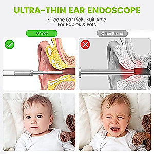 Ear Wax Removal Camera for Android Phone Tablet, Mac, PC, 1280x720HD Smart Visual Ear Cleaner with Camera Tool Kit, at Home Ear Infection Detector Ear Wax Remover Otoscope with Light