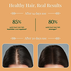 Asna Amla Berry Hair Oil, 100% COLD-PRESSED, Organic, STIMULATES NATURAL GROWTH, Nourishes & Moisturizes Hair/Scalp, AYURVEDIC Blend of VITAMIN C, Antioxidants, Essential Fatty Acids, 30ml (1 oz)