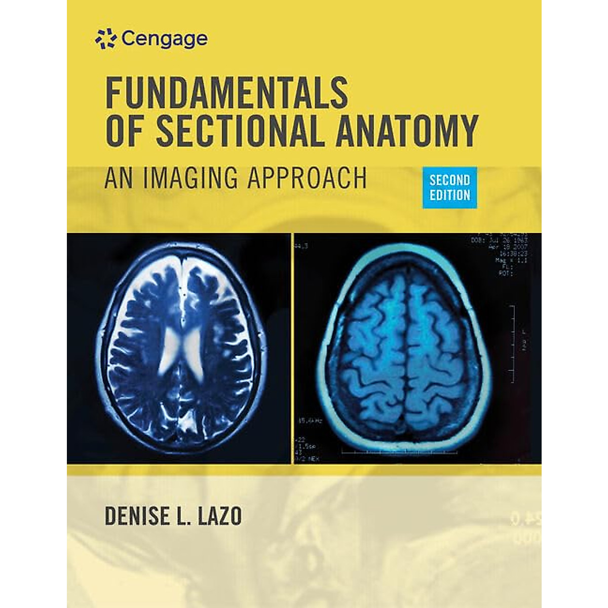 Workbook for Lazo's Fundamentals of Sectional Anatomy: An Imaging Approach, 2nd