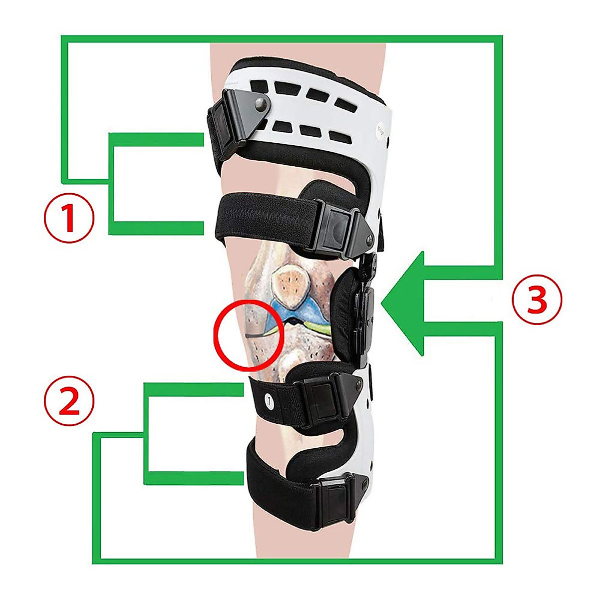 PHASFBJ Orthopedic Hinged Knee Brace, Knee Joint Splint Adjustable Leg Support Fracture Stabilizer for Men & Women ACL Ligament Injuries Sports Injuries Arthritis,Right