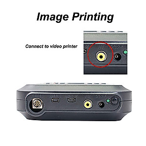 Fencia Veterinary Ultra-Sound Scanner kit Vet Ultra Sound Machine for Dog Pregnancy, Rechargeable Smart B-Ultrasound Handscan with 3.5MHz Mechanical Sector Probe for Animals Pets【US】