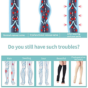 Open Toe Compression Socks 2 Pairs 20-30 mmHg Knee High Support Stockings Toeless for Men or Women Support Pregnancy, Running, Sports, Flight Travel with Free Auxiliary Wear Socks L