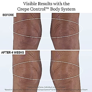 StriVectin Tighten & Lift Crepe Control Exfoliating Body Scrub, Targets Crepiness and Rough, Dull Skin, 5 Fl Oz, white