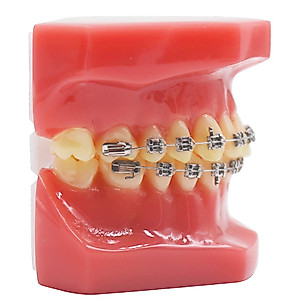 Dental Orthodontic Metal Brcket with Typodont Teeth Model