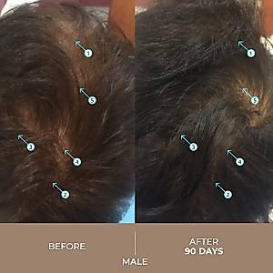 Spectral.DNC-N Hair Thickening, Strengthening Hair Serum for Men and Women by DS Laboratories - Supports Hair Growth, Minimize Shedding, Experience Thicker, Fuller, Stronger Hair, Color Safe (2 fl oz)