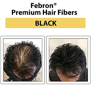 FEBRON Hair Fibers For Thinning Hair BLACK Giant 30G For Women & Men Hair Loss Concealer Hair Powder Volumizing Based 100% Undetectable & Natural - Bald Spots Filler