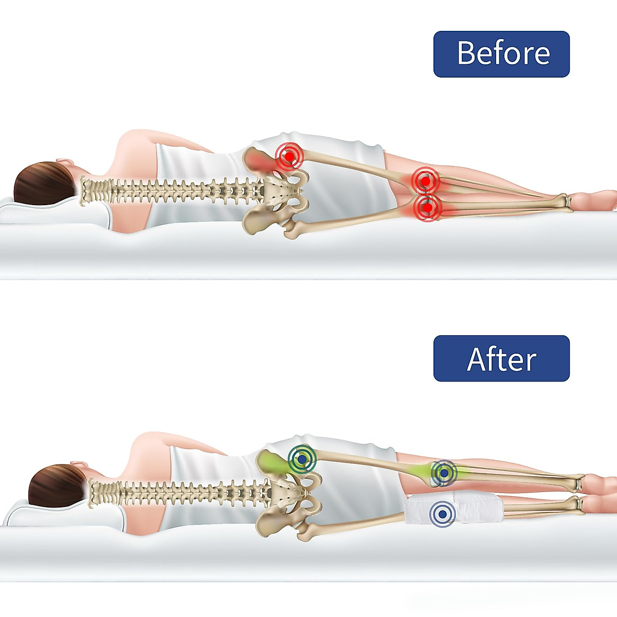 HOMBYS Knee Pillow for Side Sleepers,Down Alternative Between Leg Pillow for Sleeping,Under Knee Pillow for Sleeping on Back,Spine Alignment, Lower Back Pain Relief,Pregnancy Support,4 inch