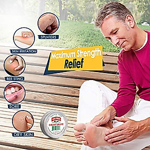 Drawing Salve Ointment 1oz, ingrown Hair Treatment, Boil & Cyst, Splinter Remover, Bug and Spider Bites, bee Sting, Mosquito bite Itch Relief, Poison Ivy, by Owell Naturals