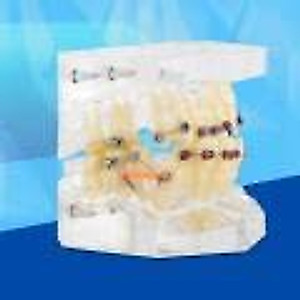 Teeth Educational Model Dental Treatment Malocclusion Study Demonstration Teeth Model with Wire Chain Orange