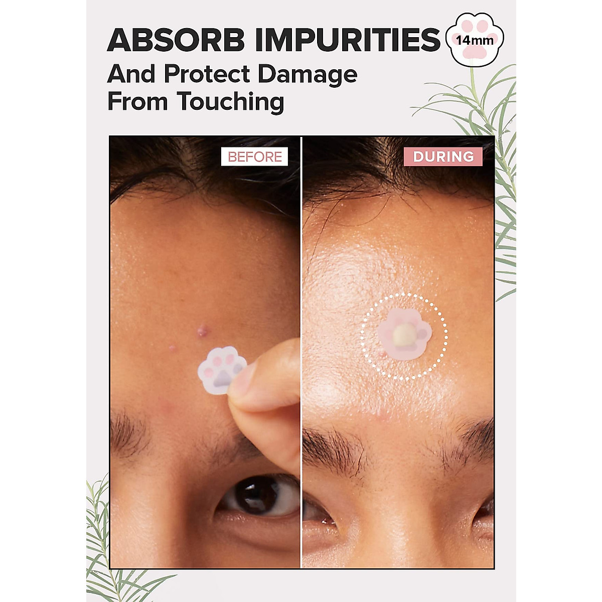 I DEW CARE Hydrocolloid Acne Pimple Patch - Timeout Blemish Happy Paws | Korean Cute Acne Patches | zit patches for face and skin, 36 Count (14mm), Facial Stickers, Absorbing with Tea Tree Leaf Oil